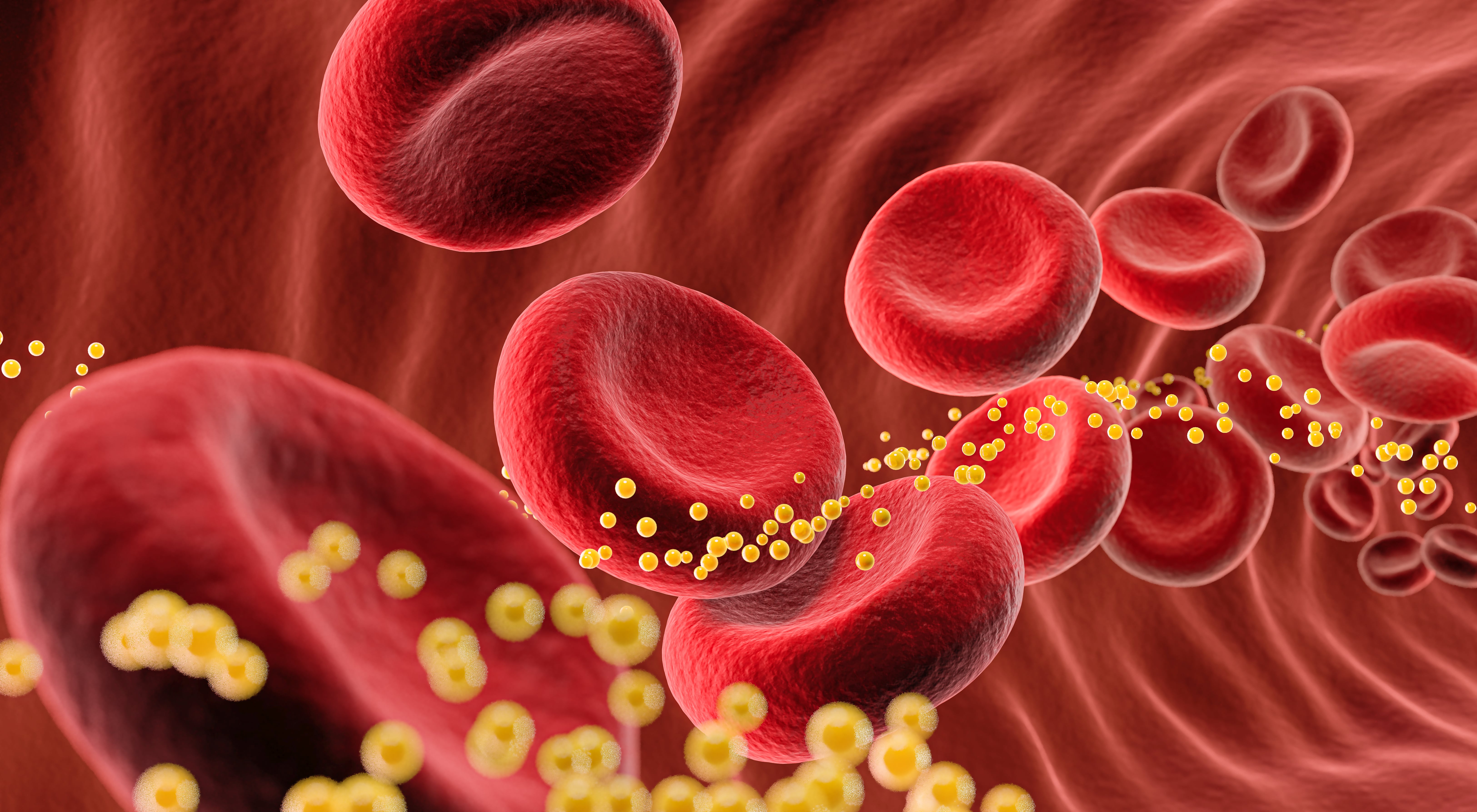 Good vs. bad cholesterol - understanding "statins" - Cooper Green